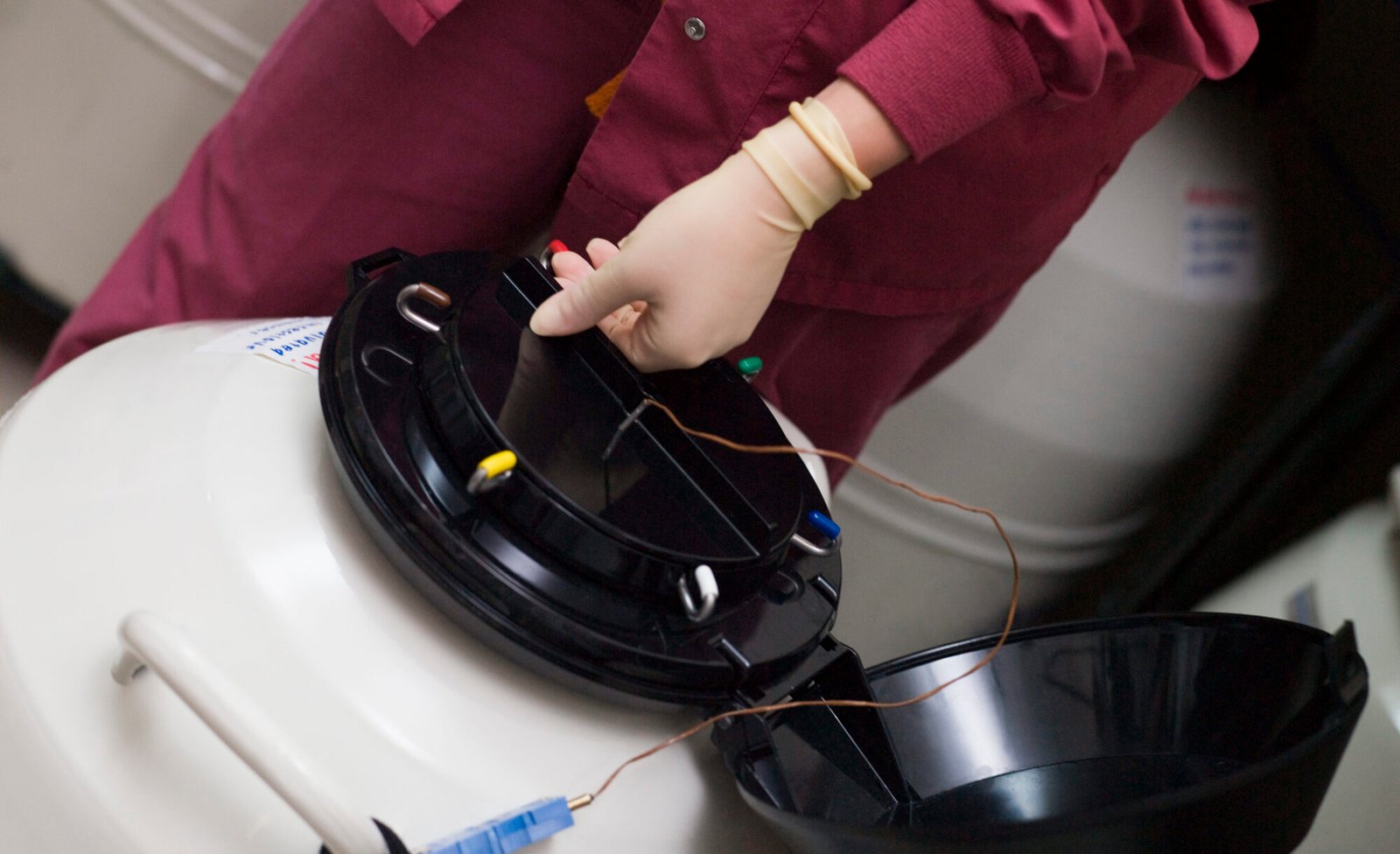 Embryo Cryopreservation FAQ